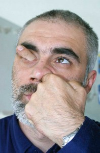 Man sticks a finger in his nose through his eye socket - Weird Picture ...
